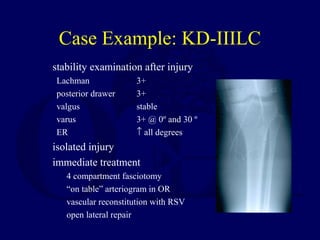 L06 knee dislocations | PPT