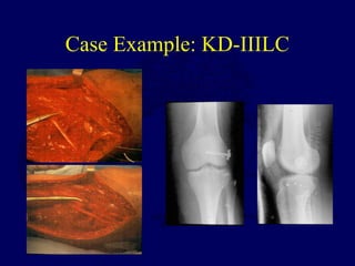 L06 knee dislocations | PPT