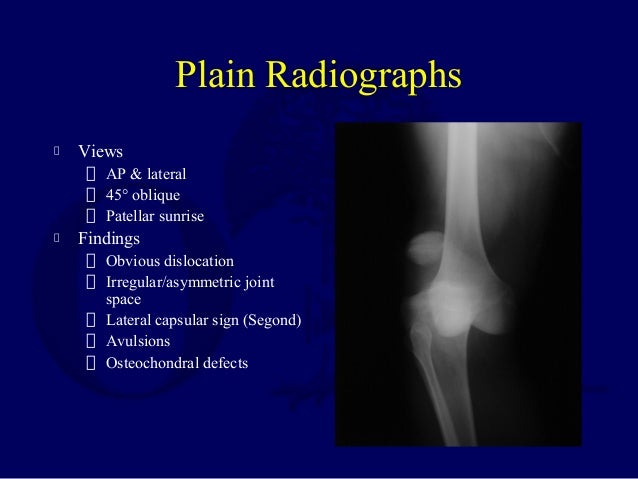 L06 knee dislocations