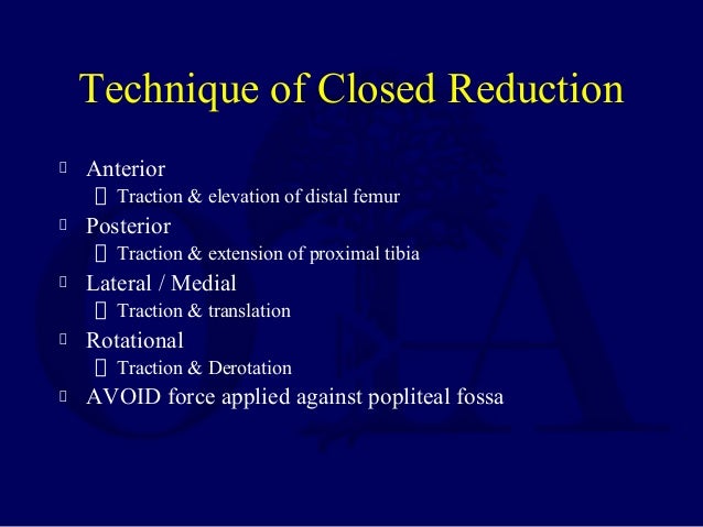 L06 knee dislocations
