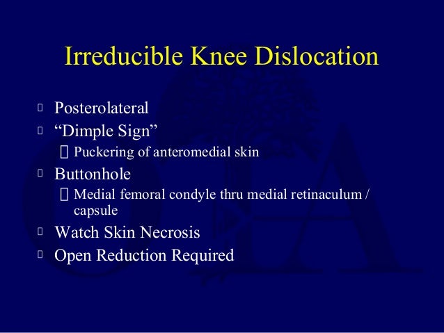 L06 knee dislocations