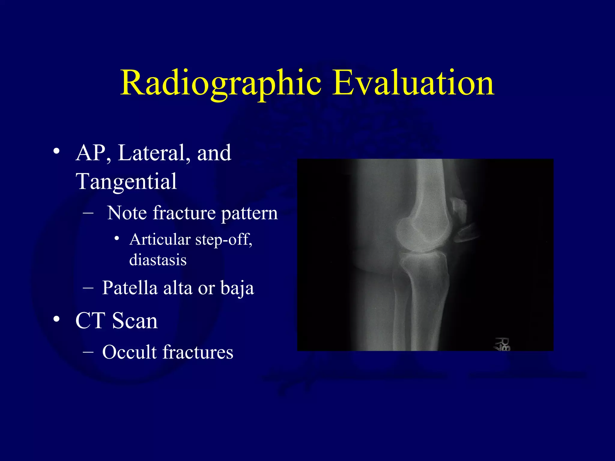L07 extensor mechnsm injury | PPT