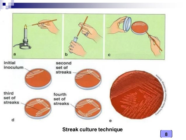 Medical Microbiology Laboratory (culture techniques)