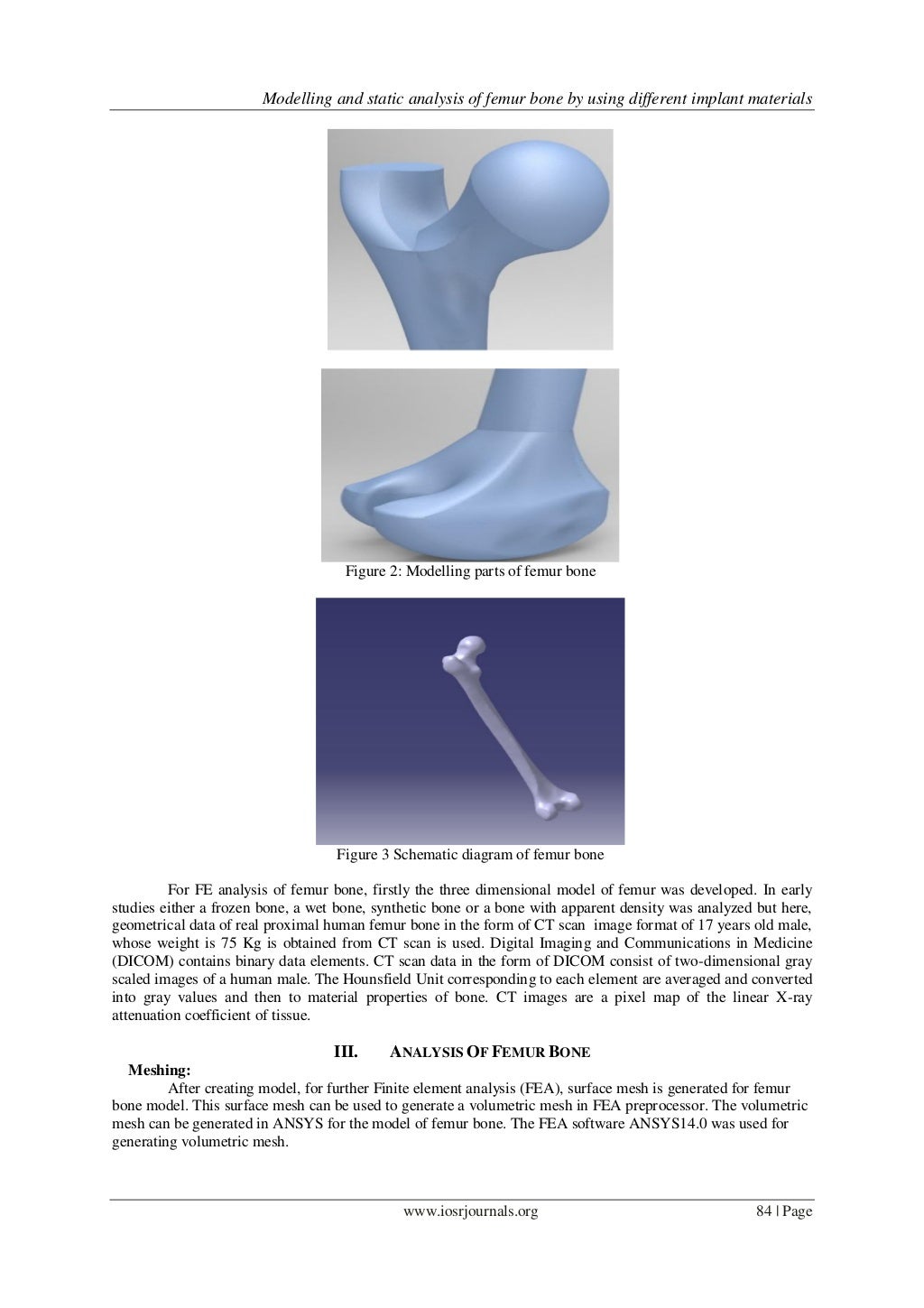 Modelling And Static Analysis Of Femur Bone By Using Different Implan…