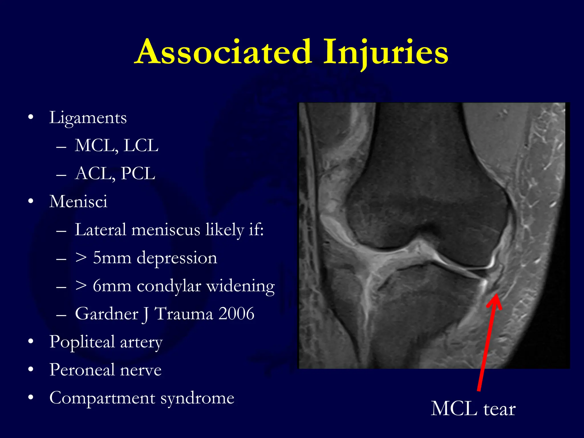 L08 - Ly Tibial Plateau Fractures-Ly-OTA-FINAL Revised5-11-2016_0.pdf