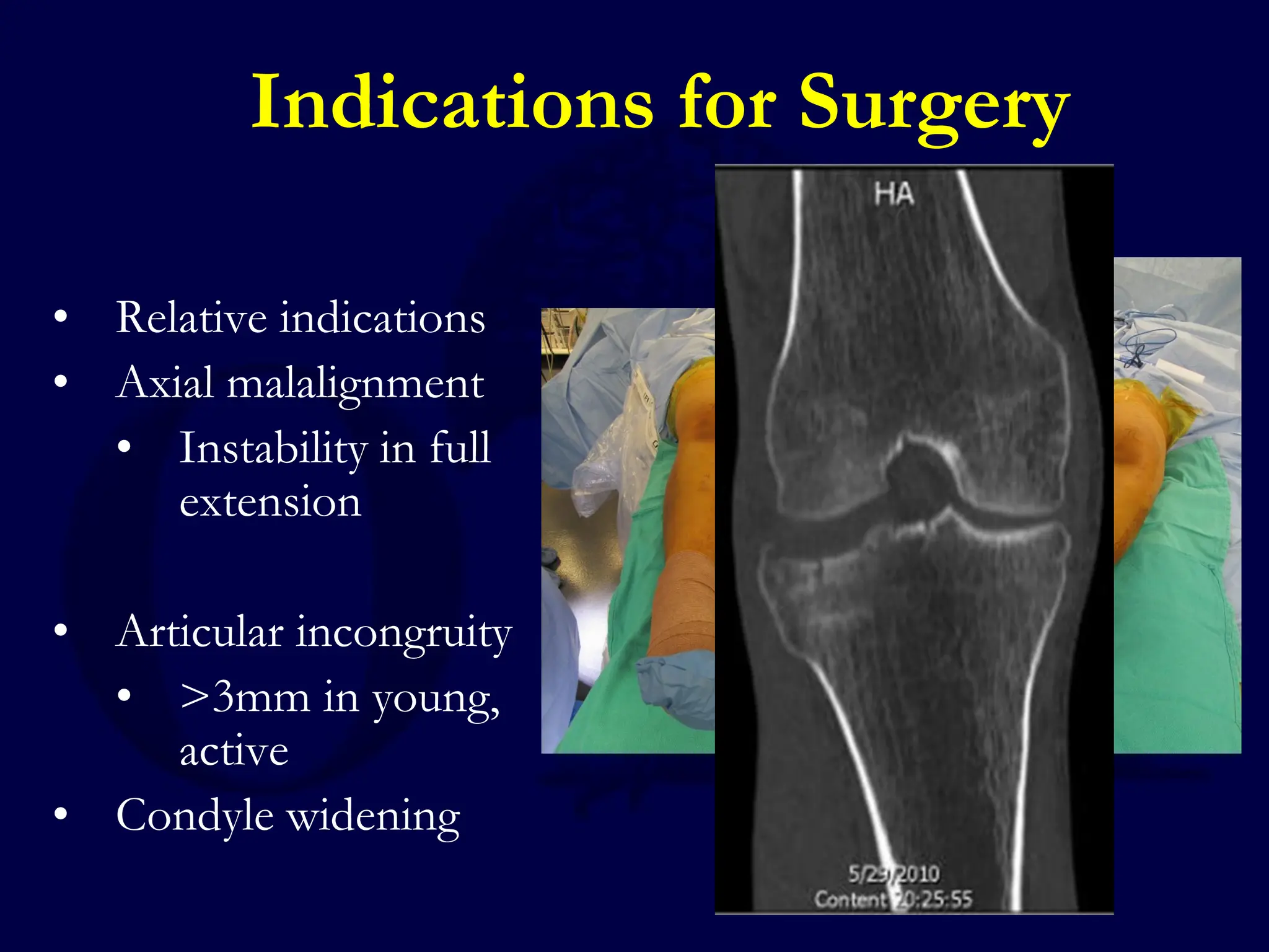 L08 - Ly Tibial Plateau Fractures-Ly-OTA-FINAL Revised5-11-2016_0.pdf