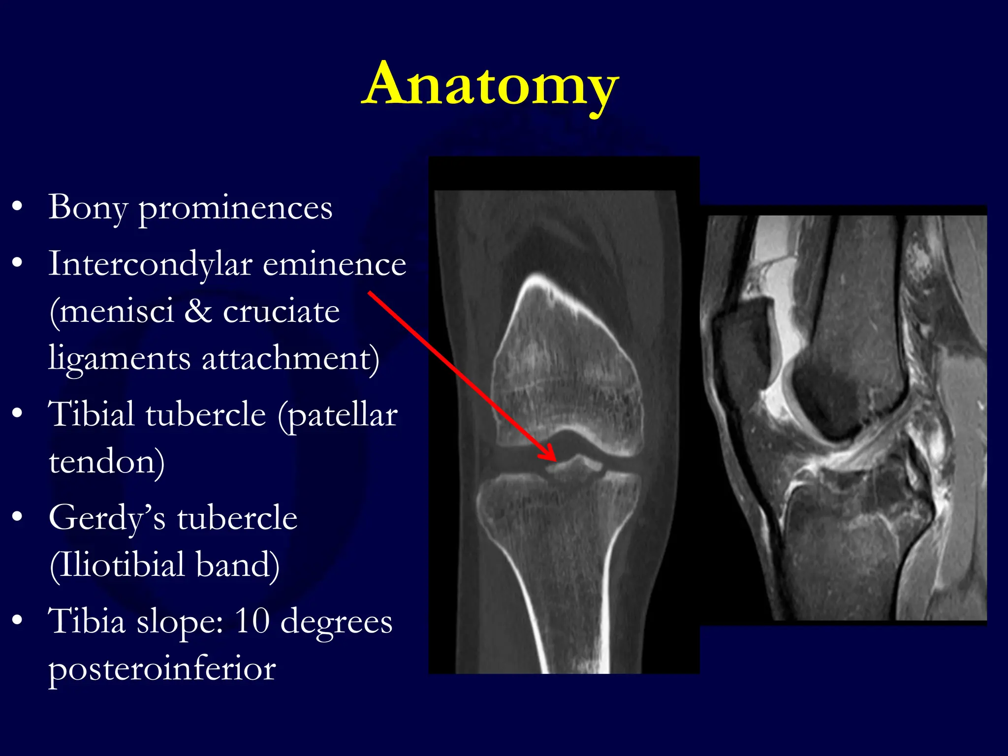 L08 - Ly Tibial Plateau Fractures-Ly-OTA-FINAL Revised5-11-2016_0.pdf