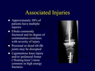 L09_OTA-Open-Tibia.ppt