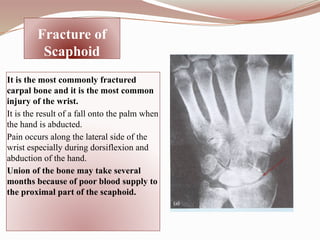 L1-Bones of upper limb.pptx Pectoral girdle, arm,forearm and hand | PPTX