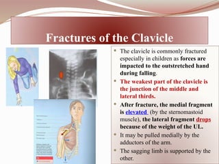 L1-Bones of upper limb.pptx Pectoral girdle, arm,forearm and hand | PPT