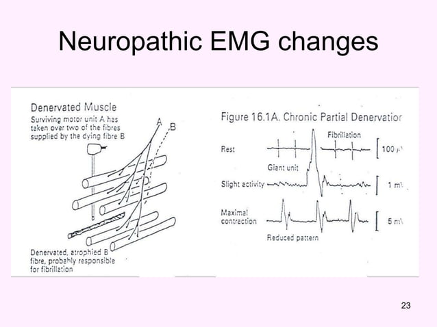 L1- EMG+MNCV.ppt