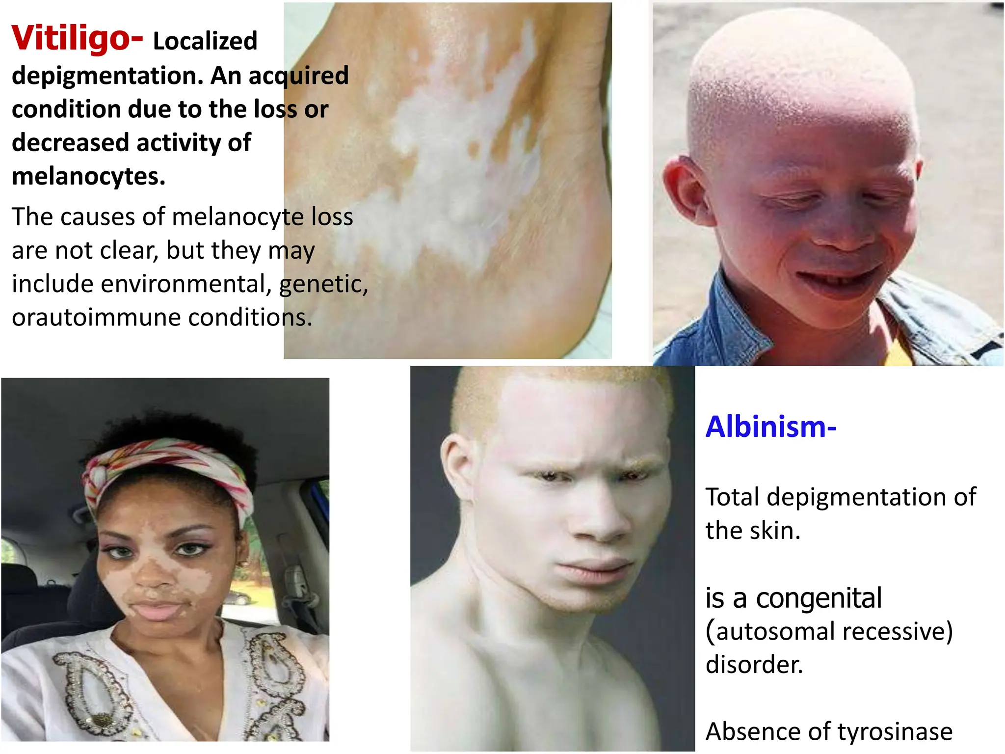 L1-SKIN-Science of Epidermis, Dermis and Subdemis(Histology and ...