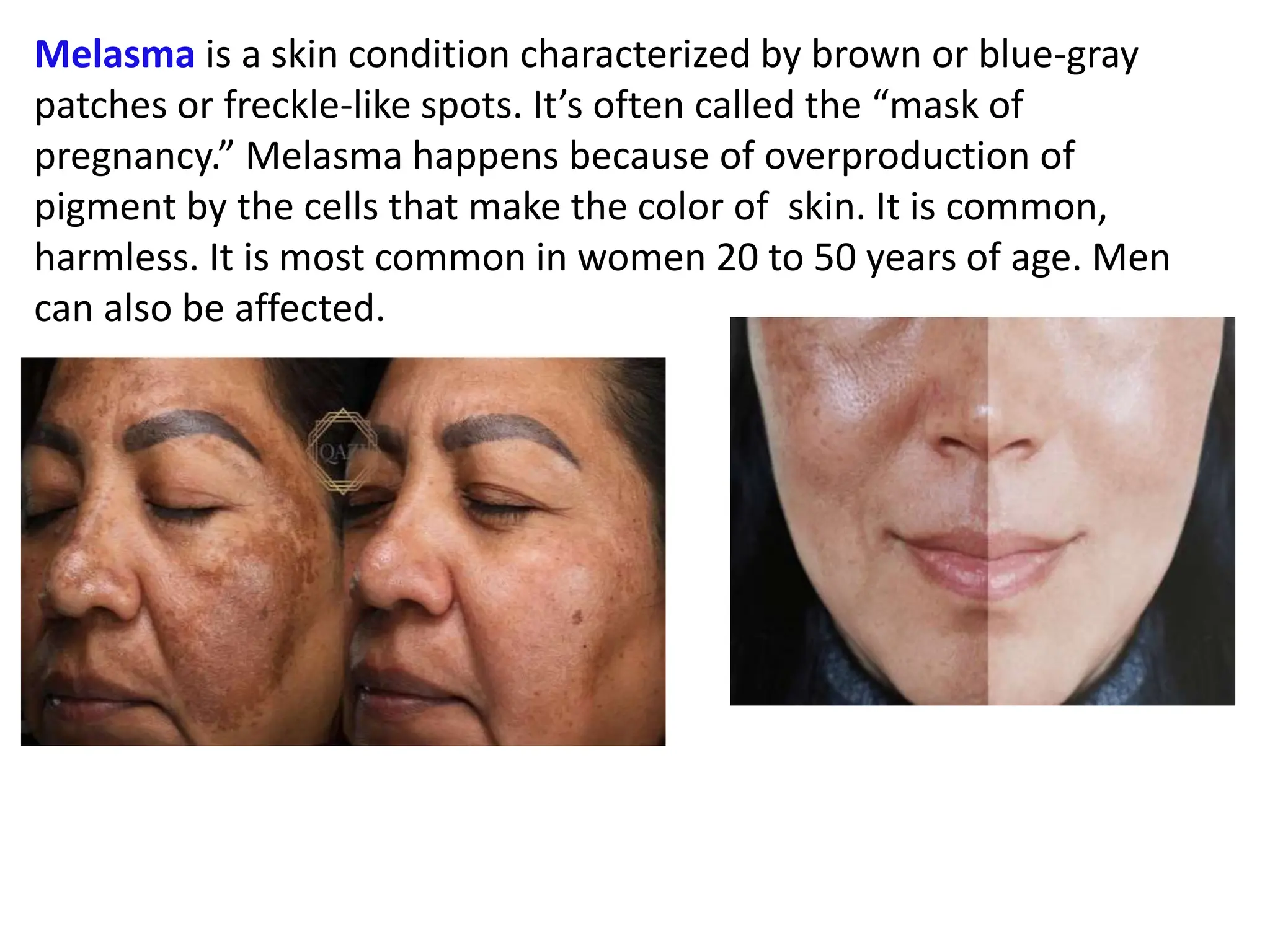 L1-SKIN-Science of Epidermis, Dermis and Subdemis(Histology and ...