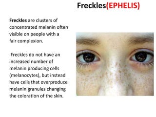 L1-SKIN-Science of Epidermis, Dermis and Subdemis(Histology and ...