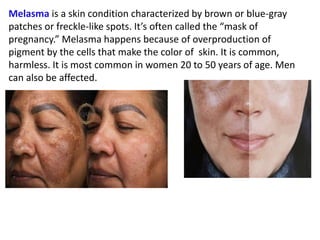 L1-SKIN-Science of Epidermis, Dermis and Subdemis(Histology and ...