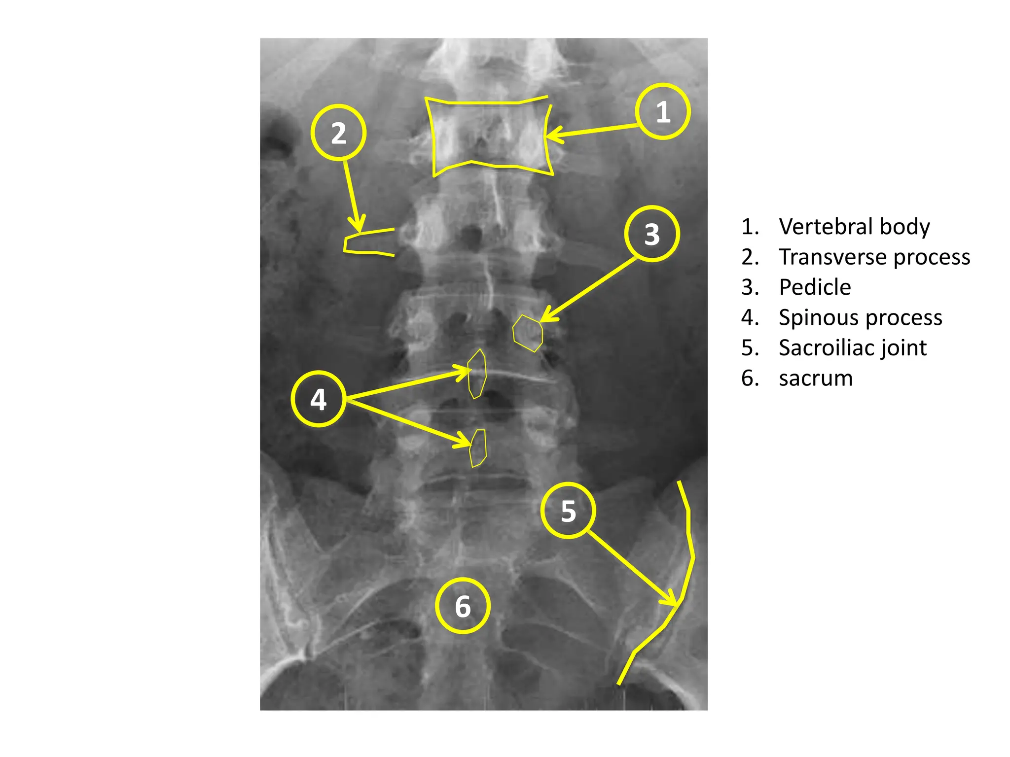 L1-vertebra Radiological -Anatomy. pptt | PPT | Death, Injury, or ...