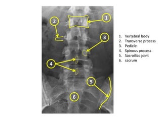 L1-vertebra Radiological -Anatomy. pptt | PPT