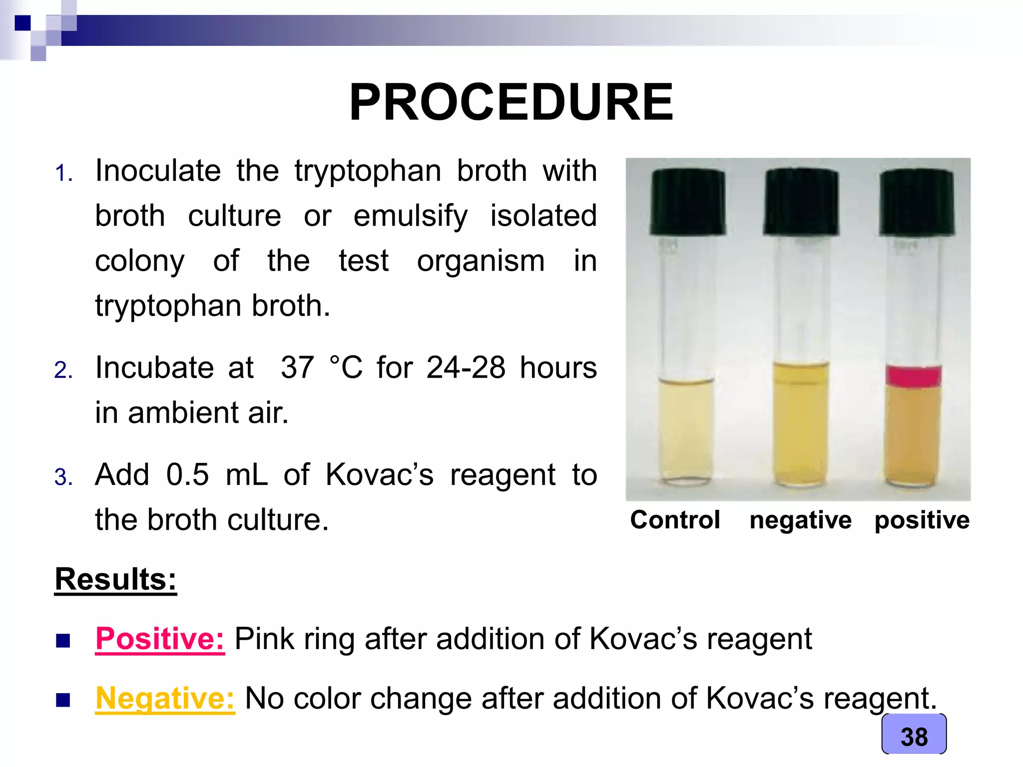 Medical Microbiology Laboratory (biochemical tests - i) | PDF