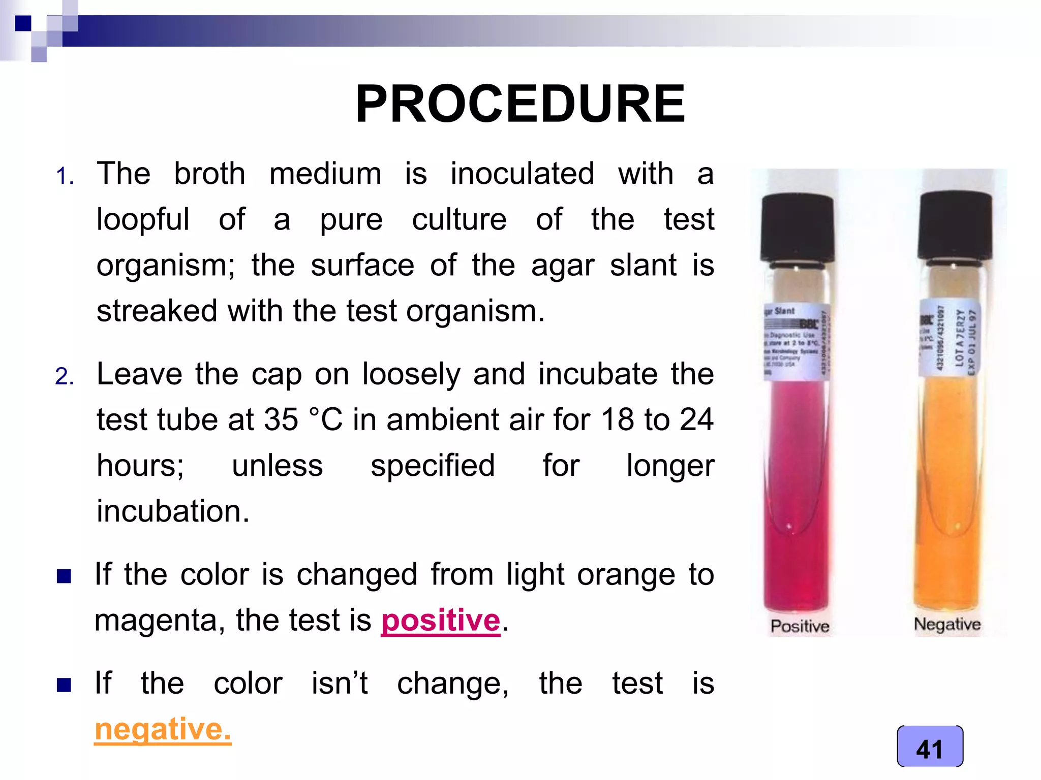 Medical Microbiology Laboratory (biochemical tests - i) | PDF | Blood ...