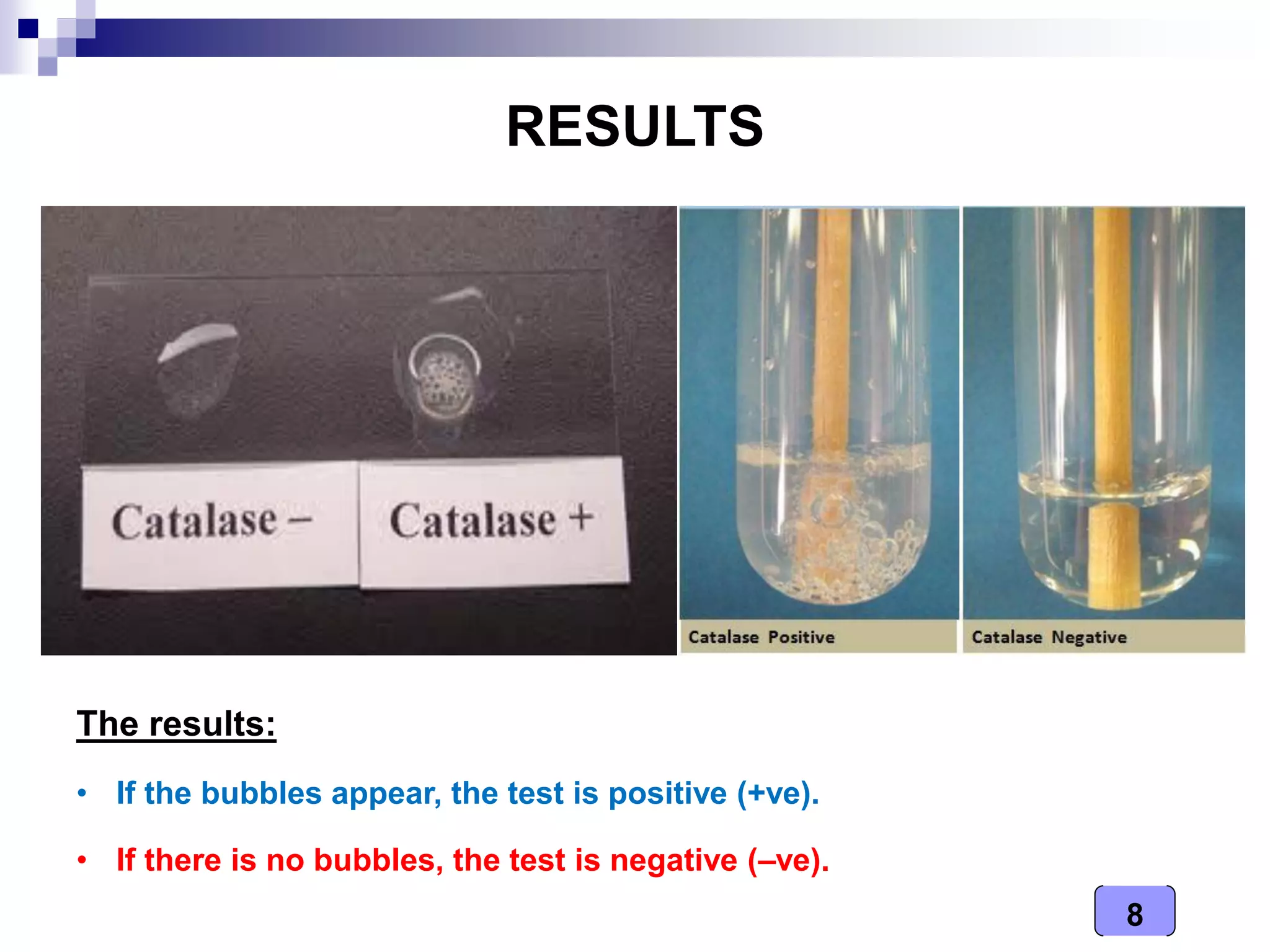 Medical Microbiology Laboratory (biochemical tests - i) | PDF | Blood ...