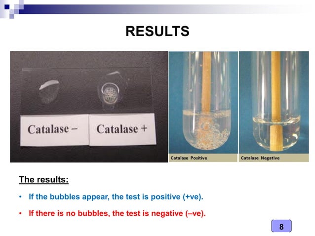 Medical Microbiology Laboratory (biochemical tests - i) | PDF | Blood ...