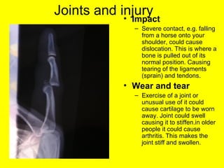 L10a Different Kinds Of Joints | PPT | Death, Injury, or Military ...