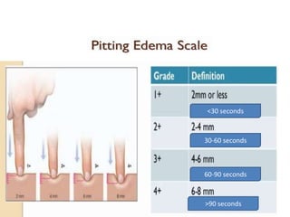 L 11 12 .Approach to edema & clubbing | PPTX