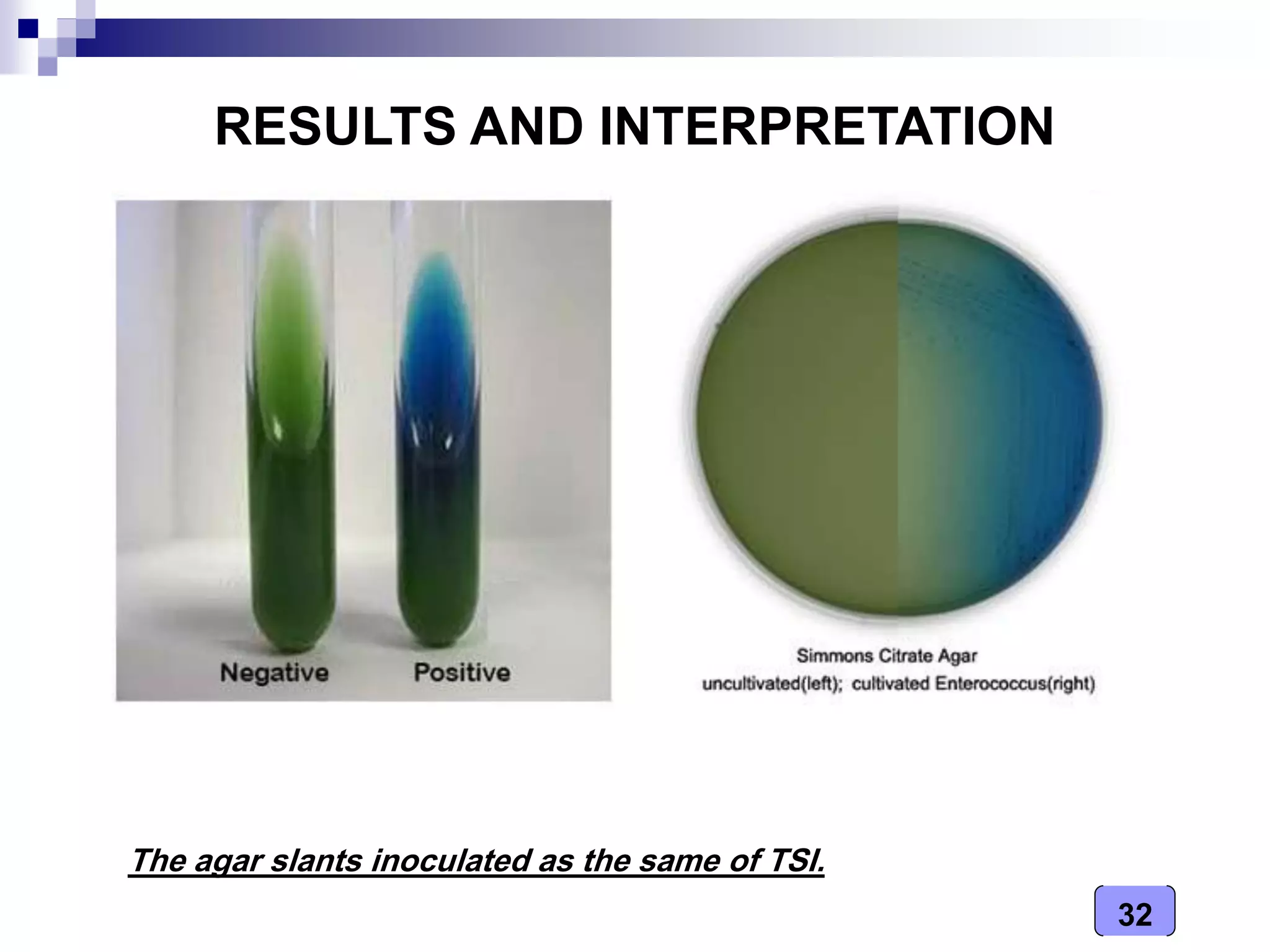 Medical Microbiology Laboratory (biochemical tests - ii) | PDF