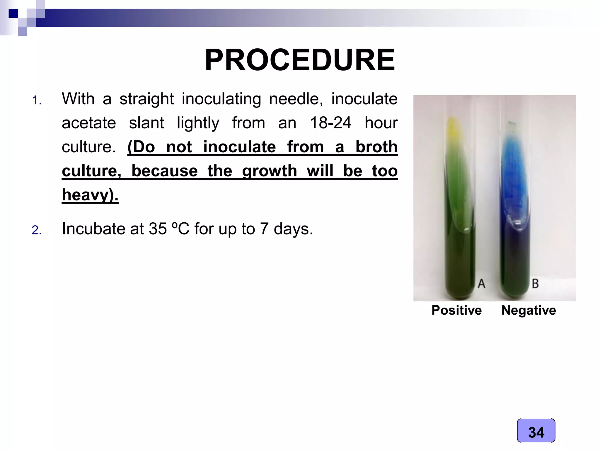 Medical Microbiology Laboratory (biochemical tests - ii) | PDF