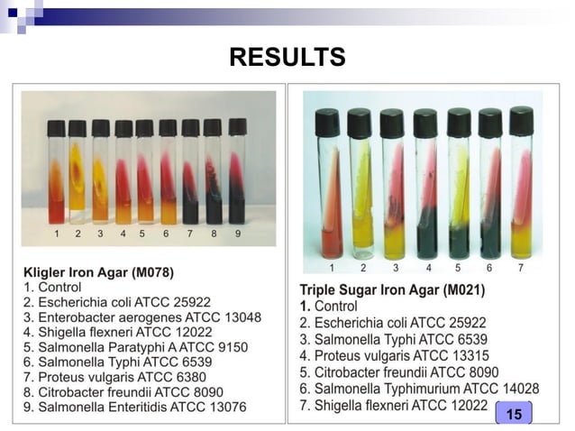 Medical Microbiology Laboratory (biochemical tests - ii) | PDF ...