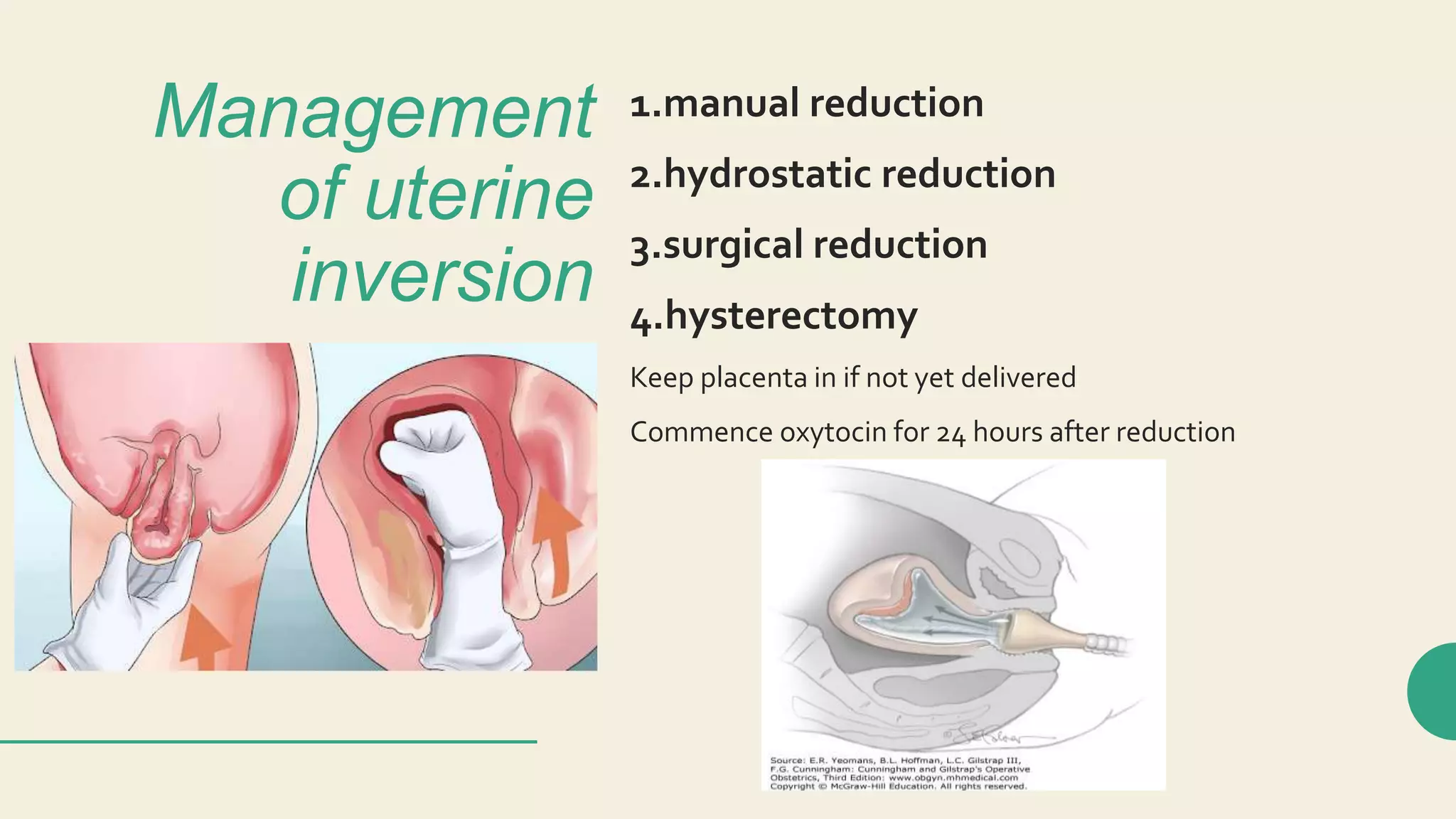 Lecture 21 Postpartum Hemorrhage .pptx