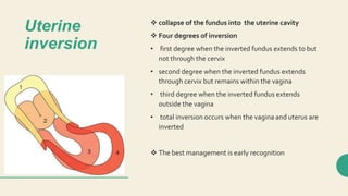 Lecture 21 Postpartum Hemorrhage .pptx | Pregnancy | Reproductive Health