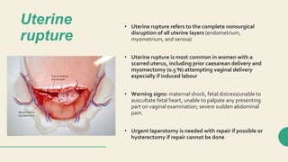Lecture 21 Postpartum Hemorrhage .pptx