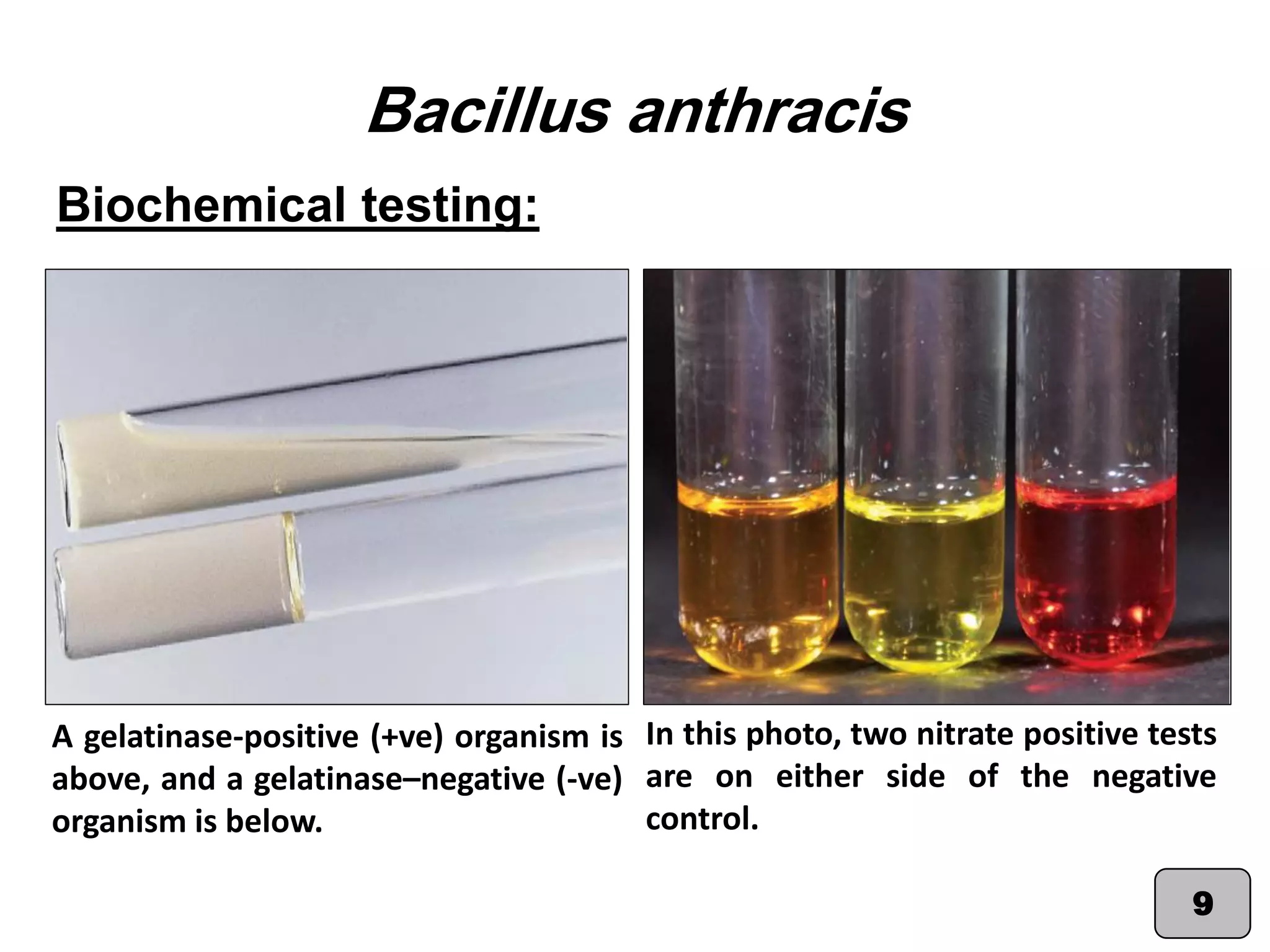 Bacillus spp. (Practical Medical Microbiology, 12) | PDF