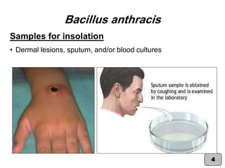 Bacillus spp. (Practical Medical Microbiology, 12) | PDF