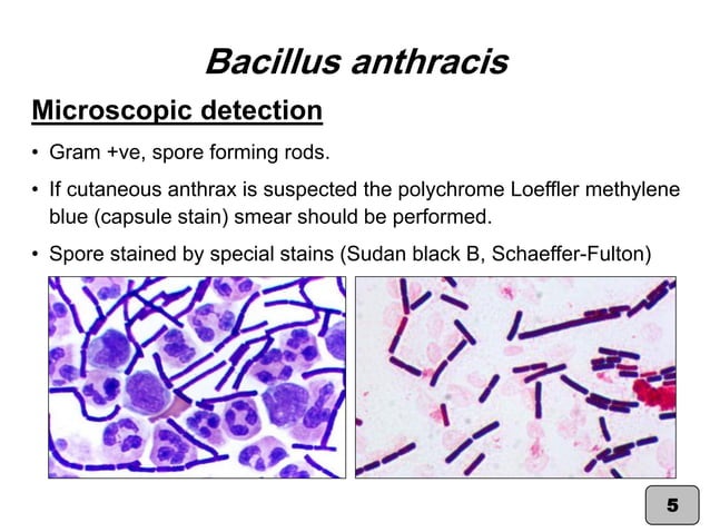 Bacillus spp. (Practical Medical Microbiology, 12) | PDF