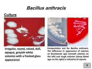 Bacillus spp. (Practical Medical Microbiology, 12) | PDF