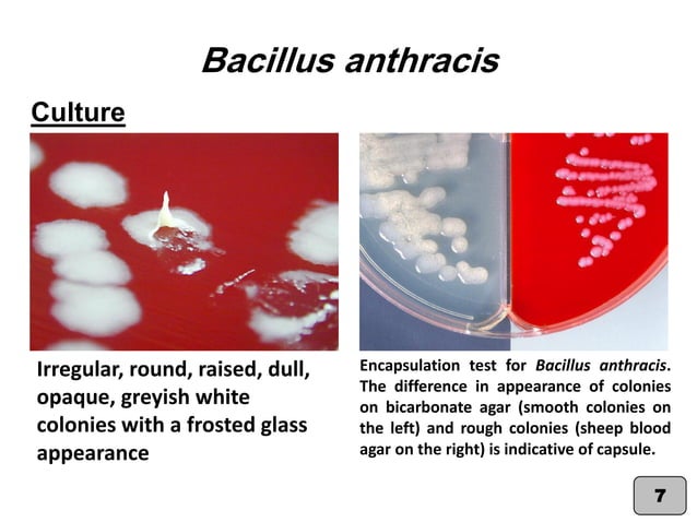 Bacillus spp. (Practical Medical Microbiology, 12) | PDF