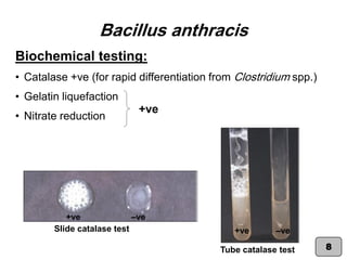 Bacillus spp. (Practical Medical Microbiology, 12) | PDF