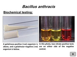 Bacillus spp. (Practical Medical Microbiology, 12) | PDF