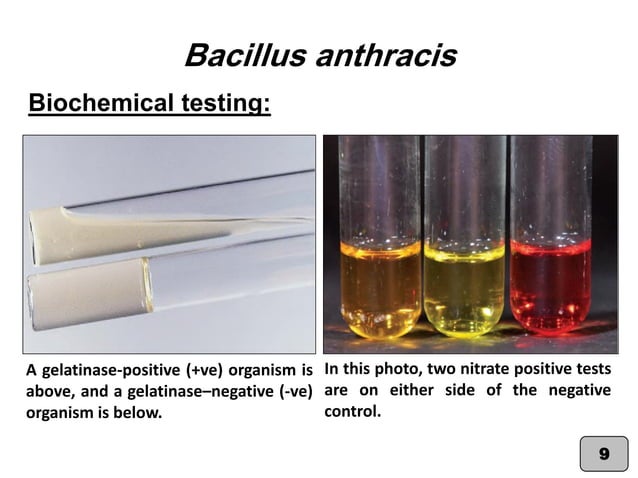 Bacillus spp. (Practical Medical Microbiology, 12) | PPT