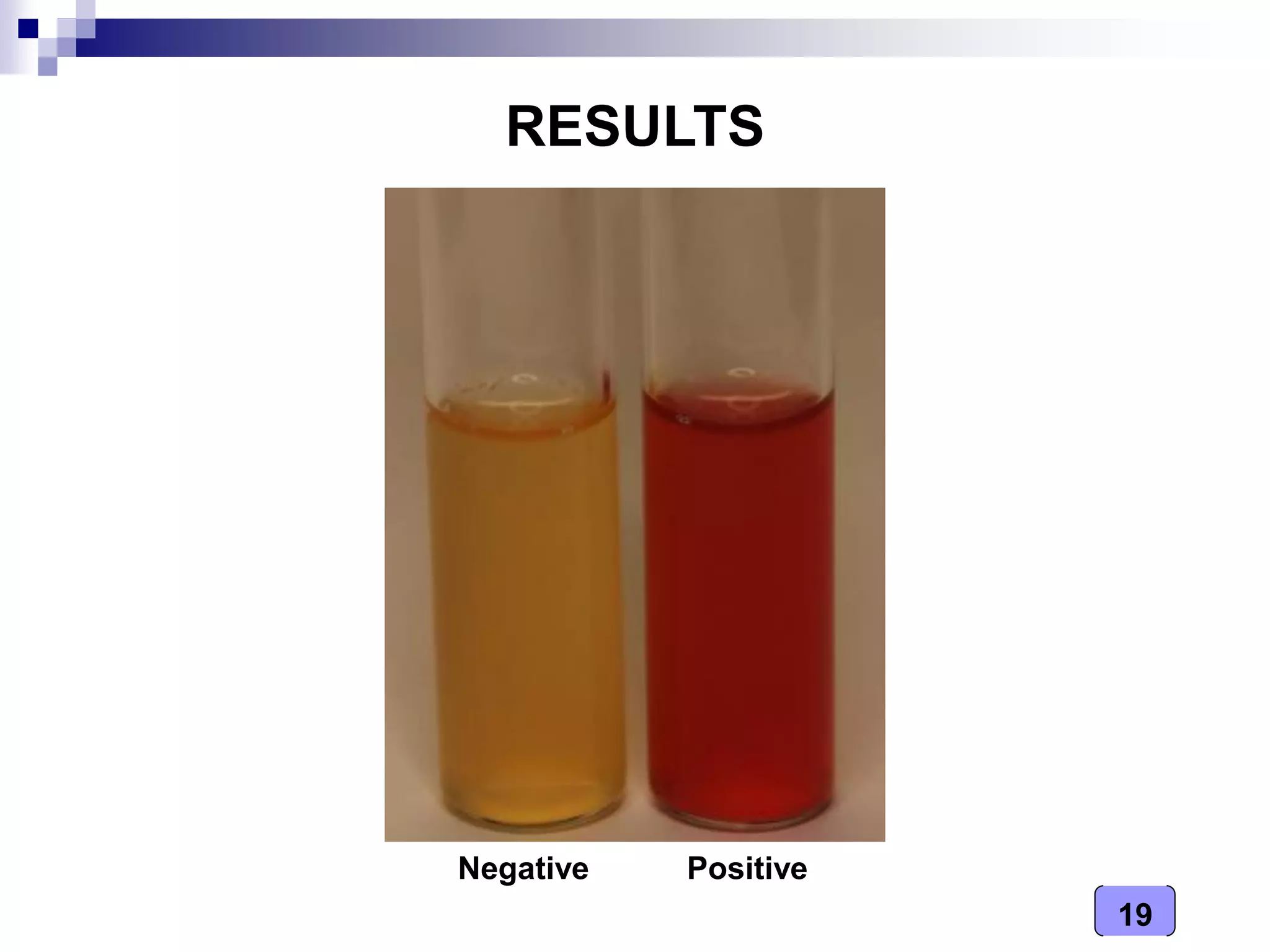 Medical Microbiology Laboratory (biochemical tests - iii) | PDF