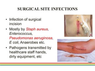 Hospital Acquired Infections and Health associated infections | PPTX