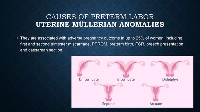 Lecture 22 Preterm Labor.pptx