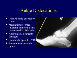 L13 ankle ligament injuries | PPT