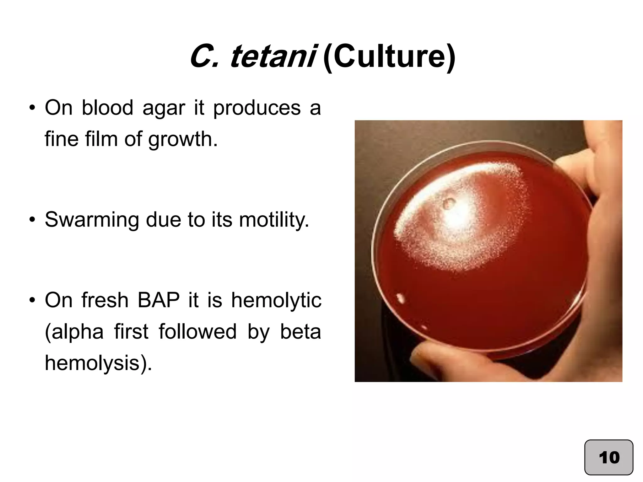 Clostridium spp. (Practical Medical Microbiology, 13) | PDF