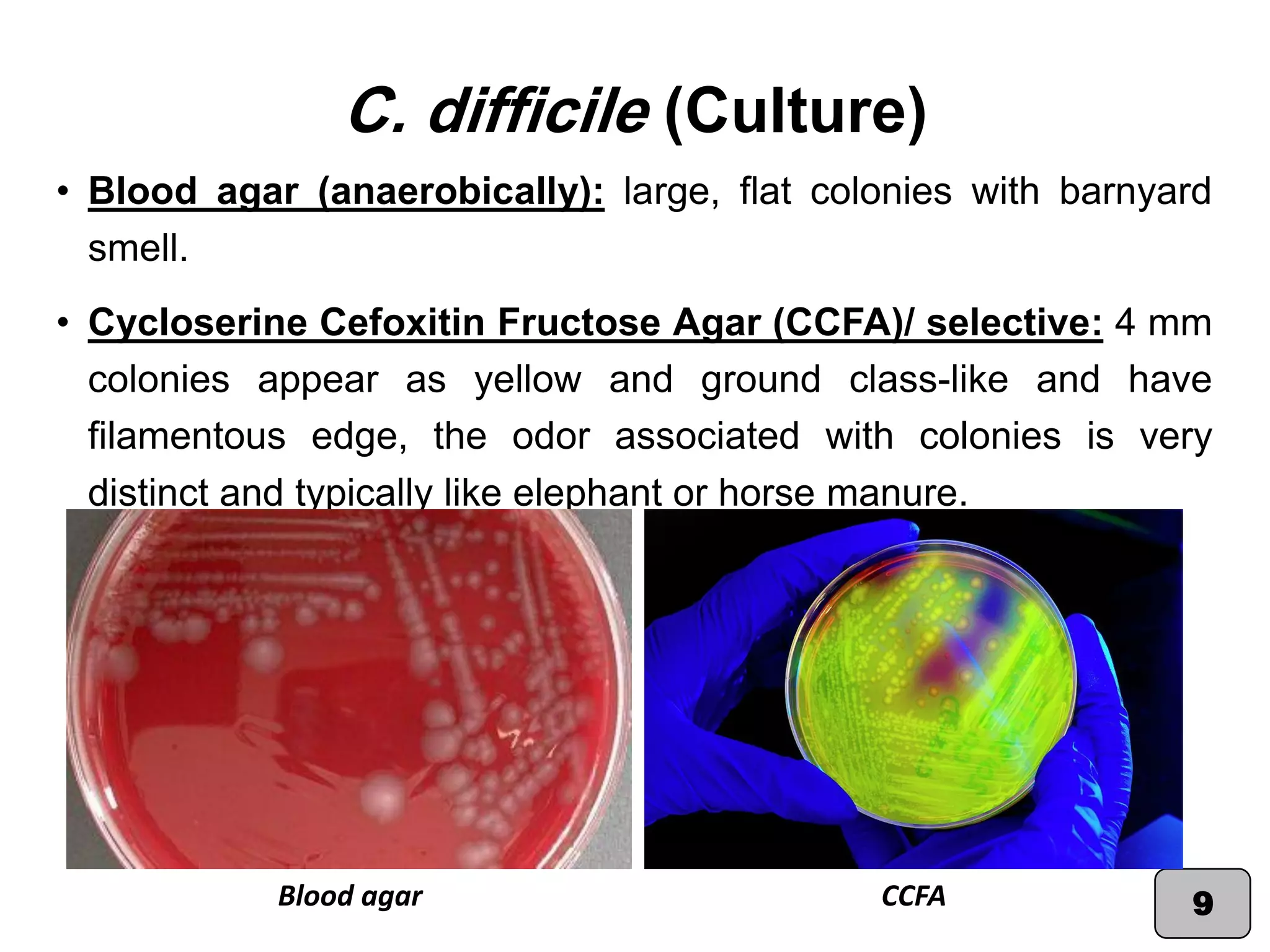 Clostridium spp. (Practical Medical Microbiology, 13) | PDF