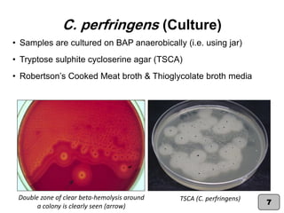 Clostridium spp. (Practical Medical Microbiology, 13) | PDF