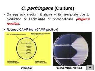 Clostridium spp. (Practical Medical Microbiology, 13) | PDF
