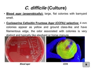 Clostridium spp. (Practical Medical Microbiology, 13) | PDF